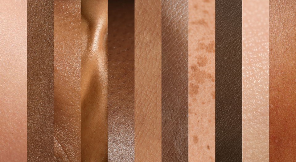 Forskere kurerer mystisk, dødelig hudsygdom med banebrydende teknologi ...