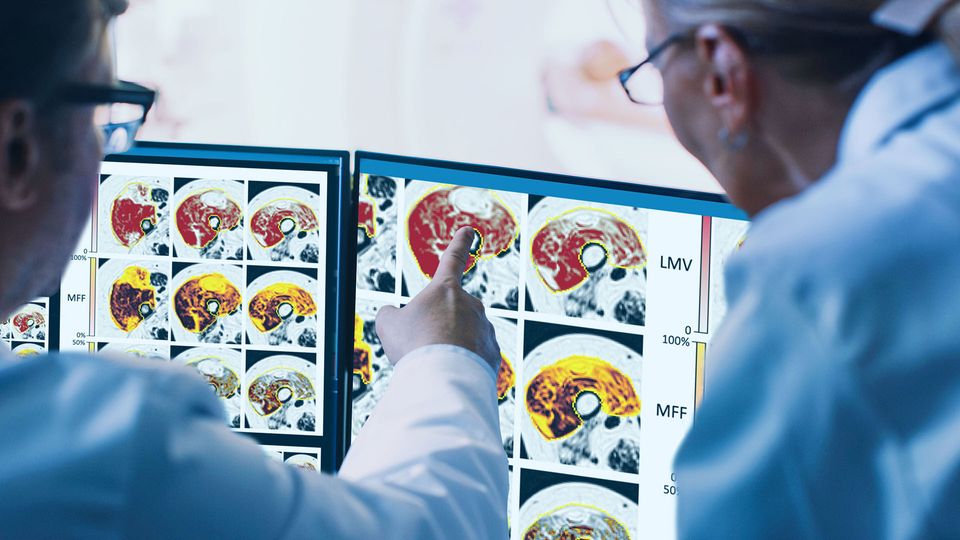 Decoding Duchenne Muscular Dystrophy: MRI Study Explores the ...